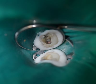 Importanta Microscopului