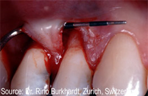 Importanta Microscopului